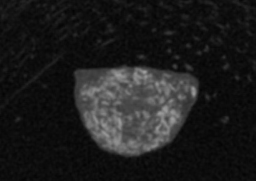 NMP Technology | Induce Biologics Bone Regeneration Science